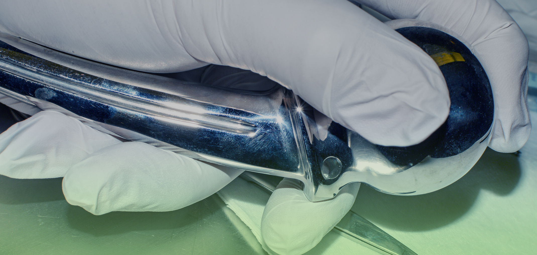 Defective Medical Devices - Hip Implant - Allen & Nolte